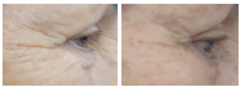 Astrion™ - Vegan Collagen Synthesis for Skin | NuLiv Science